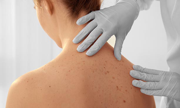 Melanoma and Skin Cancer Care